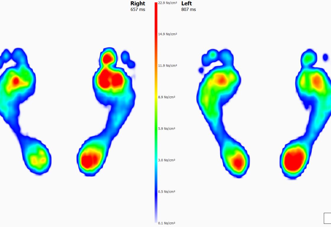 Foot Orthotics - custom orthotics | The Medical